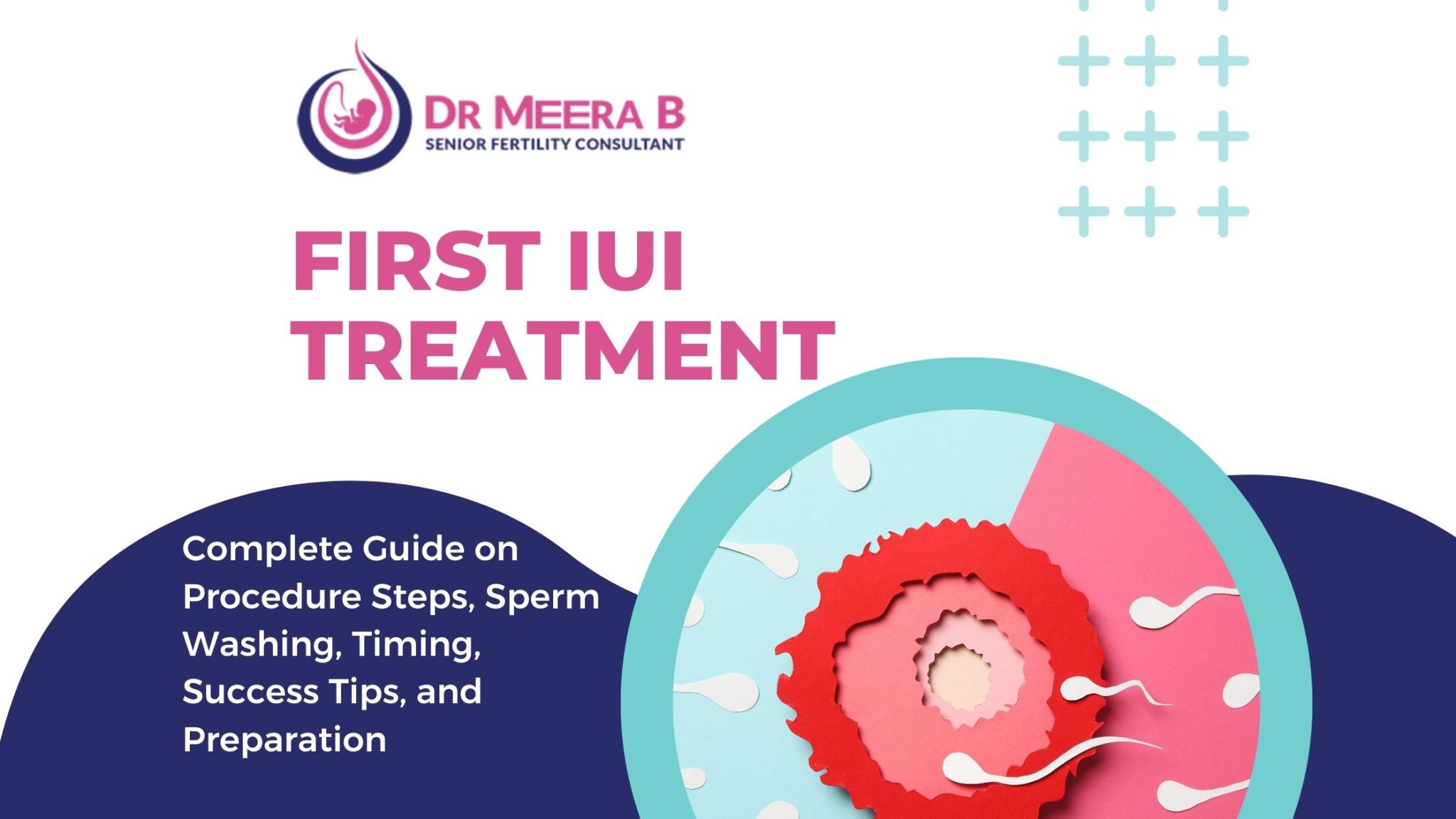First IUI Treatment: Complete Guide on Procedure Steps, Sperm Washing ...